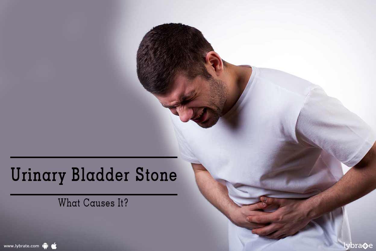 Urinary Bladder Stone - What Causes It? - By Dr. Amit Goel | Lybrate