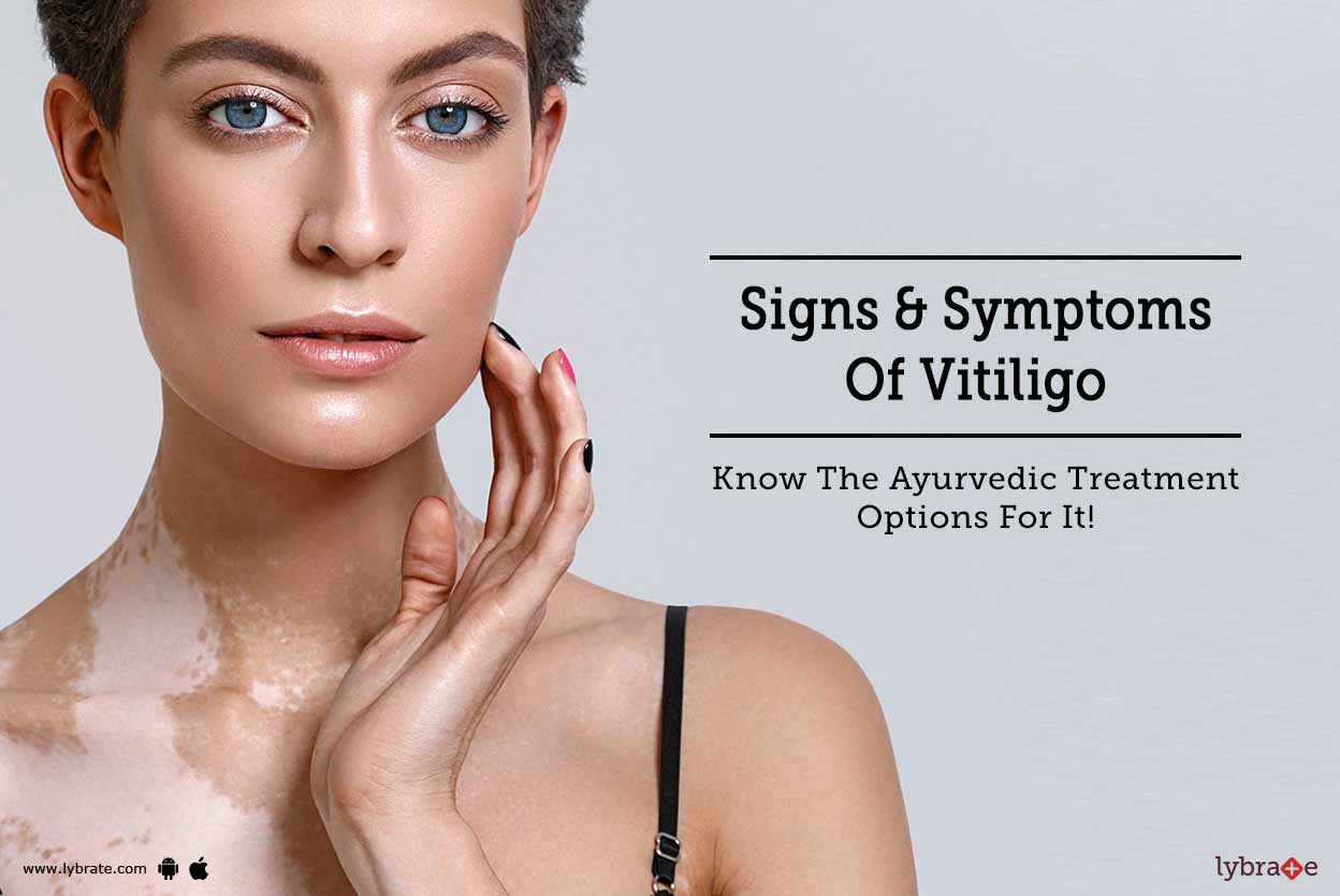 Signs And Symptoms Of Vitiligo Know The Ayurvedic Treatment Options For