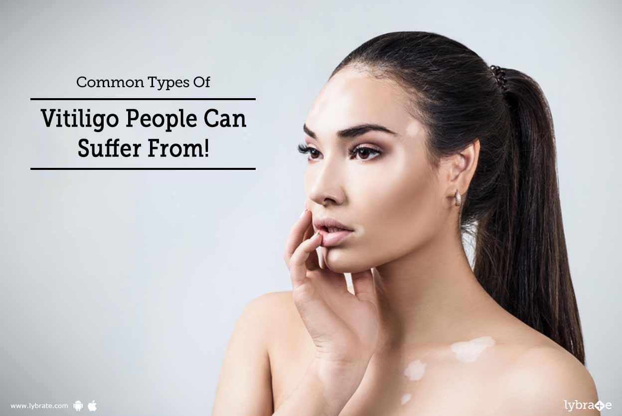 Common Types Of Vitiligo People Can Suffer From! - By Dr. R P Soni ...