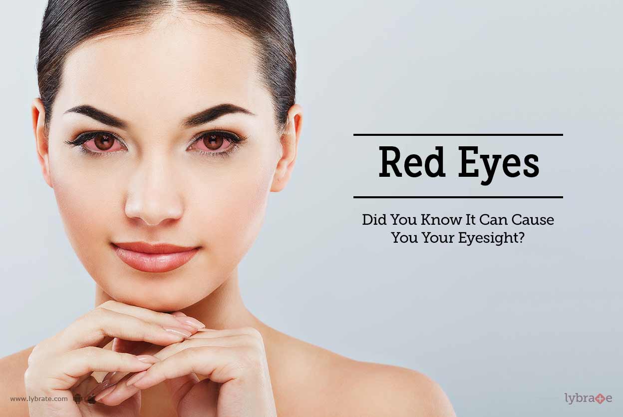 Red Eyes - Did You Know It Can Cause You Your Eyesight? - By Dr ...
