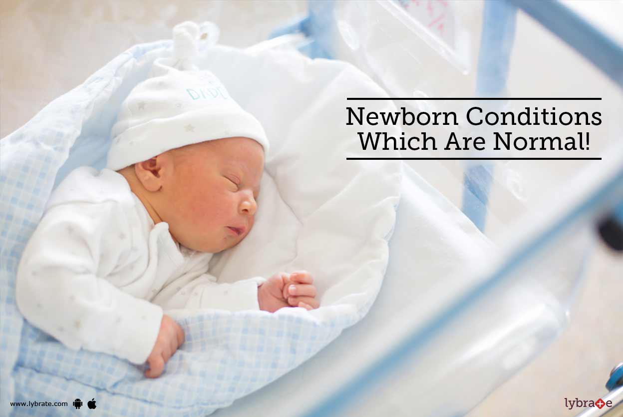 Newborn Conditions Which Are Normal! - By Dr. Supriya Rastogi | Lybrate