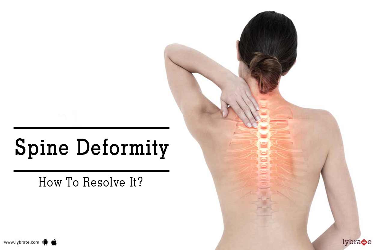 Spine Deformity - How To Resolve It? - By Dr. Rajesh Verma | Lybrate