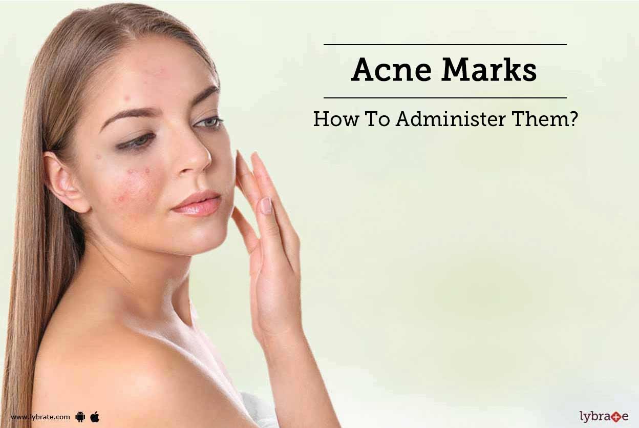 Acne Marks - How To Administer Them? - By Dr. Vishal Koshiya | Lybrate