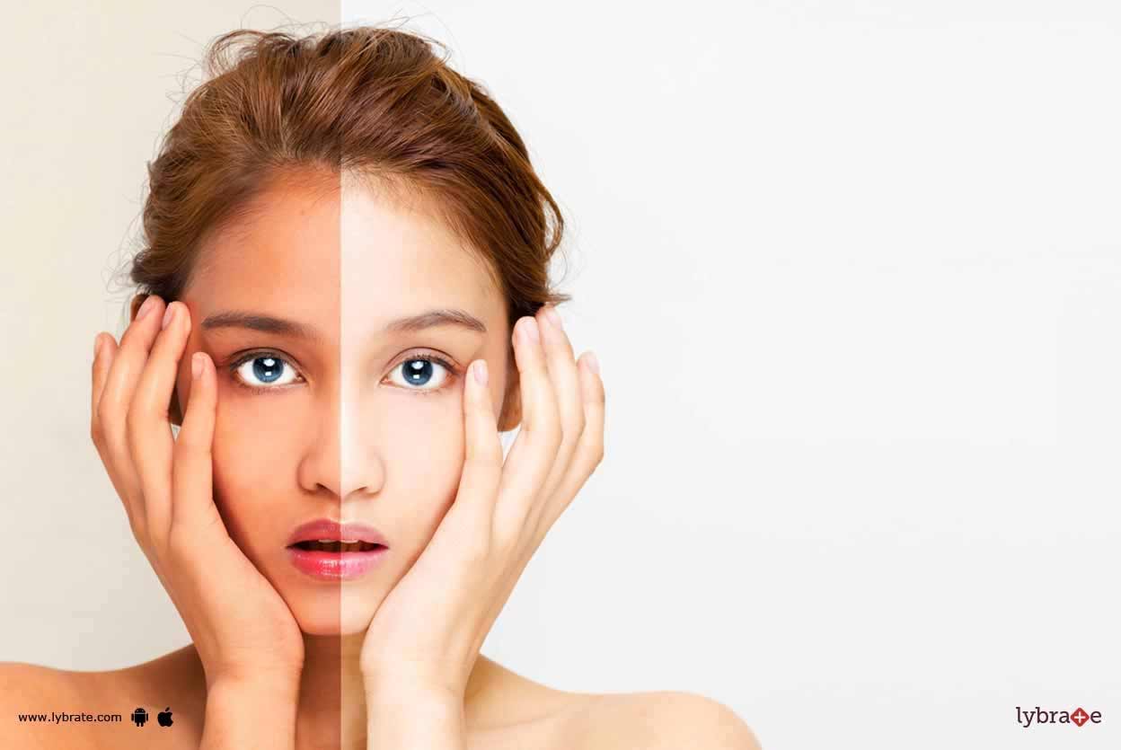 How To Reverse & Revive Sun-Damaged Skin? - By Dr. Sachin Chaudhari ...