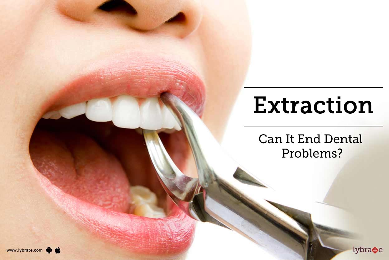 Extraction - Can It End Dental Problems? - By Dr. Ruchi Lohia | Lybrate