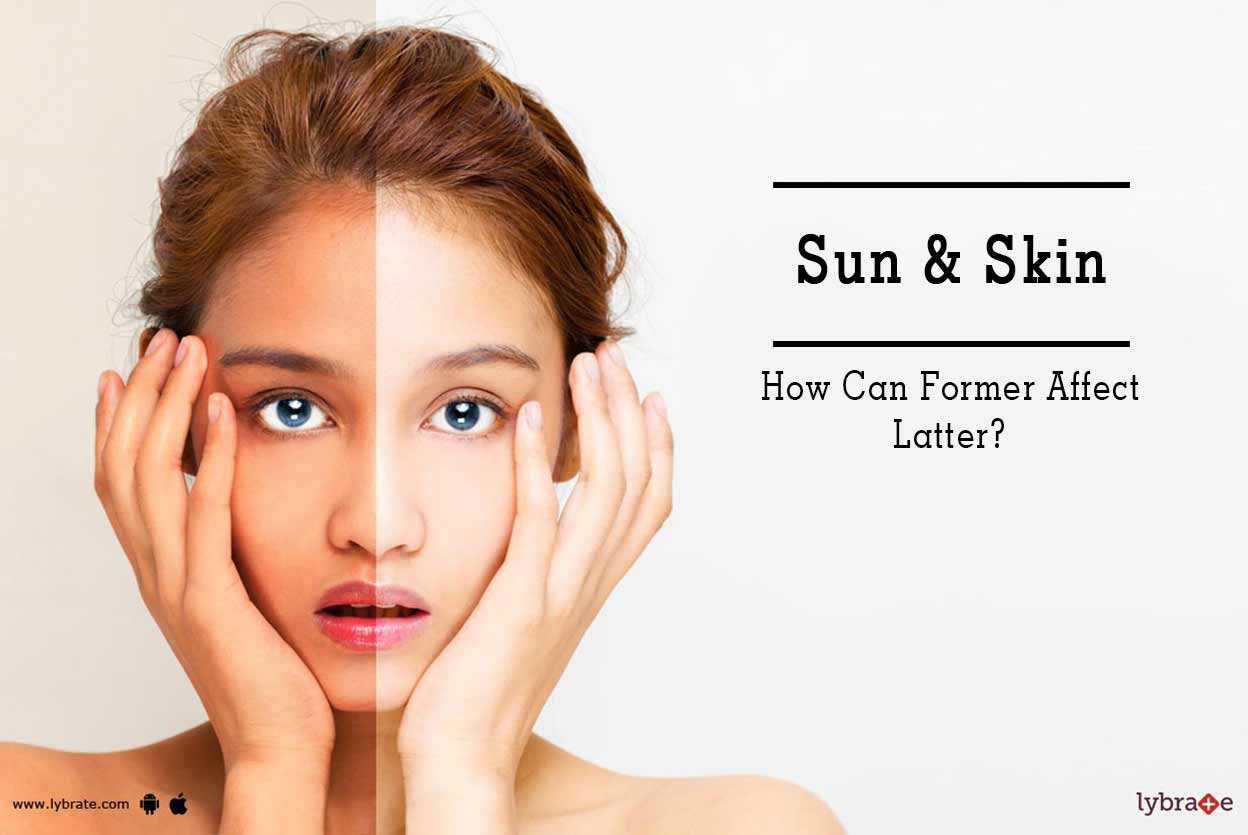 Sun & Skin - How Can Former Affect Latter? - By Dr. B Lakshmi Divya ...