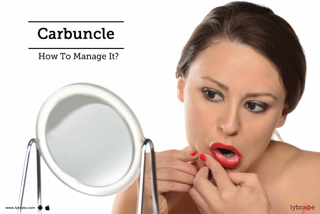 Carbuncle - How To Manage It? - By Dr. Lakshman Phonde | Lybrate