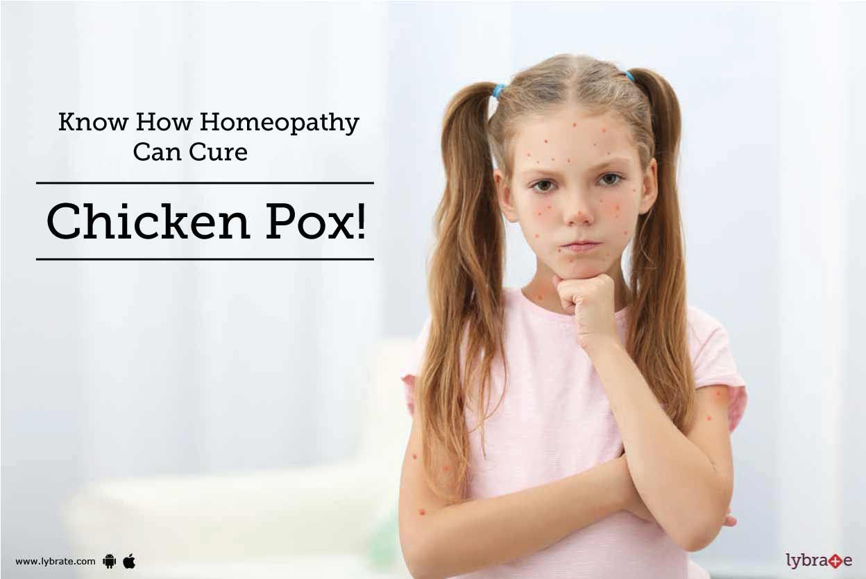 Know How Homeopathy Can Cure Chicken Pox! - By Dr. Aradhana Pathak ...