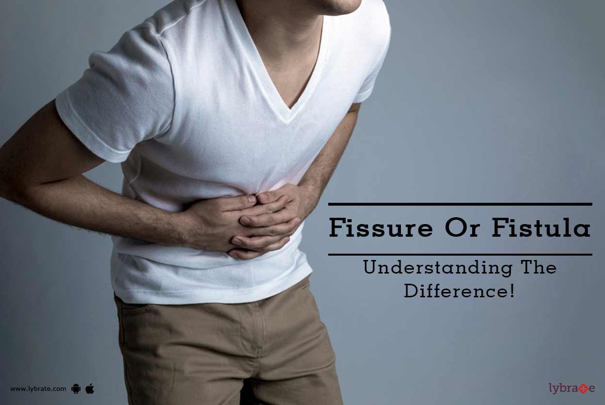 Fissure Or Fistula - Understanding The Difference! - By Maven Medical ...