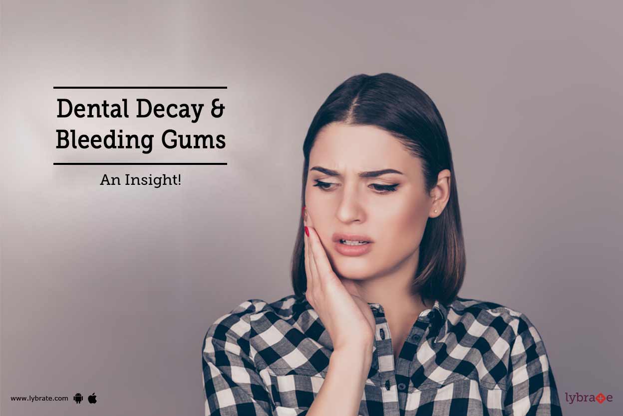 Dental Decay & Bleeding Gums - An Insight! - By Dr. Vikram Singh Atwal ...