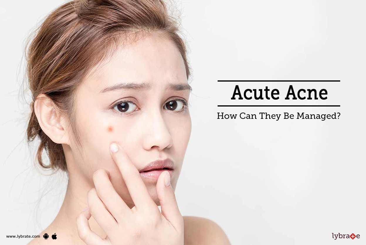 Acute Acne - How Can They Be Managed? - By Dr. Sayantani Chakraborty ...