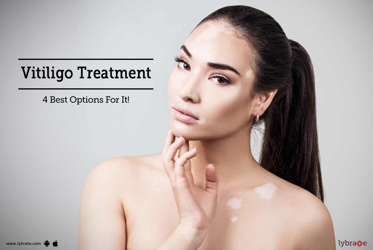 Vitiligo Treatment - 4 Best Options For It! - By Dr. Tarunveer Singh ...