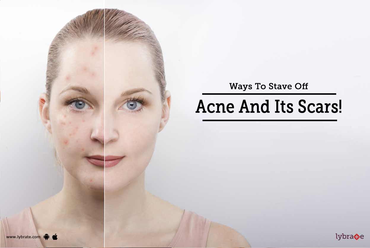 Ways To Stave Off Acne And Its Scars! - By Dr. Shaurya Rohatgi | Lybrate