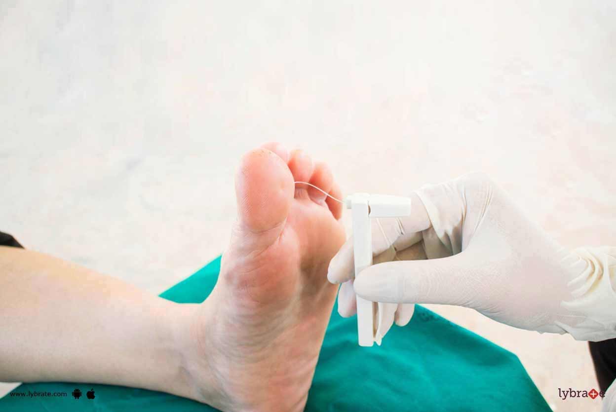 Diabetic Foot Surgery - Know Forms Of It! - By Dr. Pradeep Kumar Mishra ...