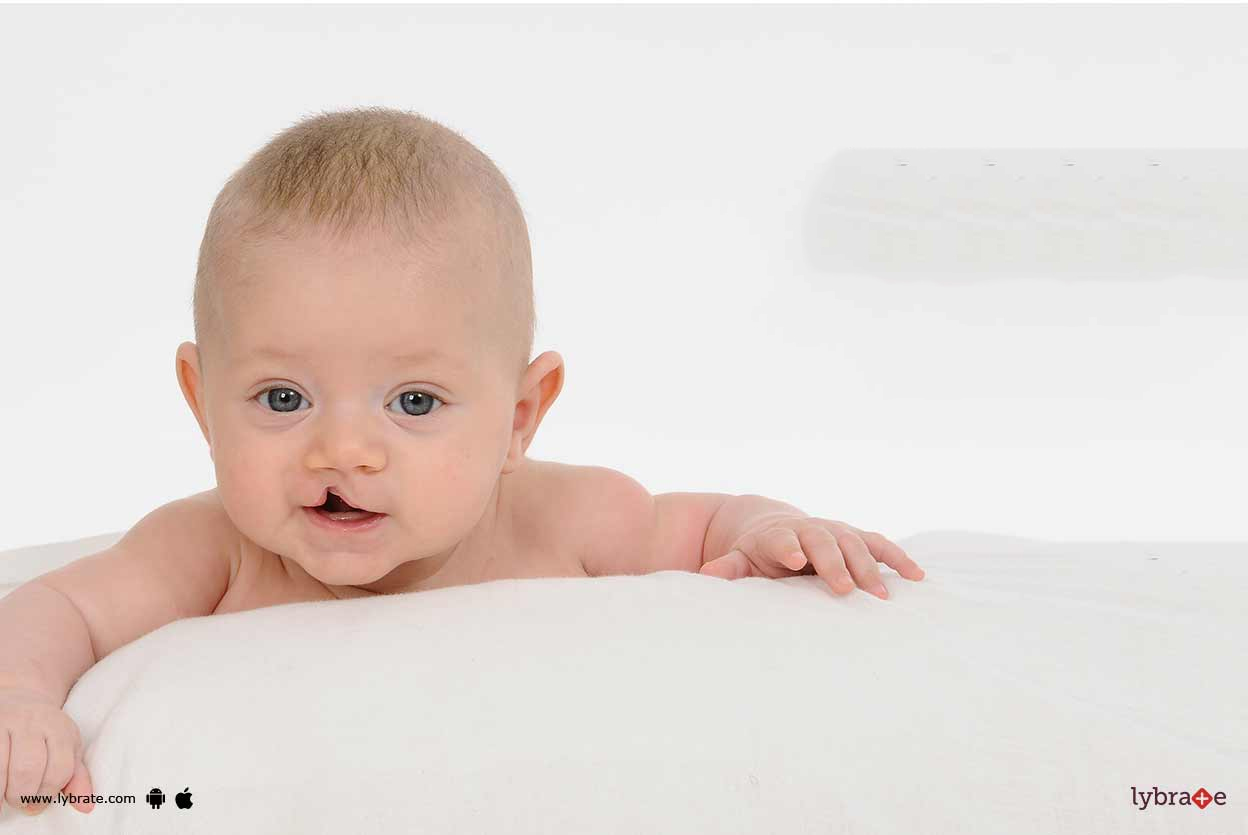 Cleft Lip - How To Resolve It? - By Dr. Mithilesh Mishra | Lybrate