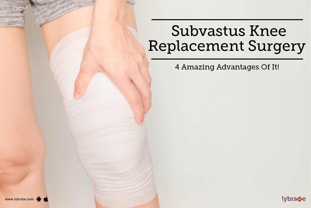 Subvastus Knee Replacement Surgery - 4 Amazing Advantages Of It! - By ...