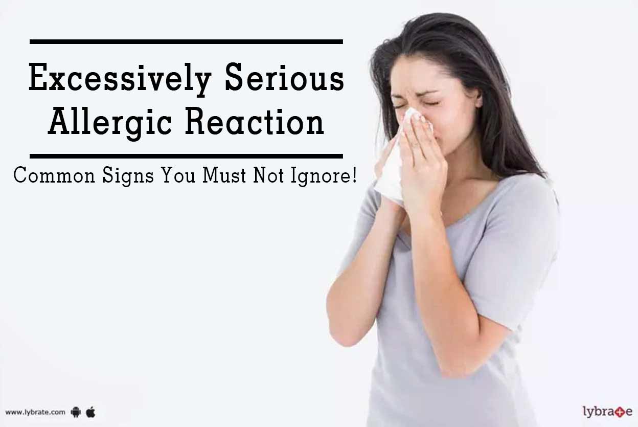 Excessively Serious Allergic Reaction - Common Signs You Must Not ...