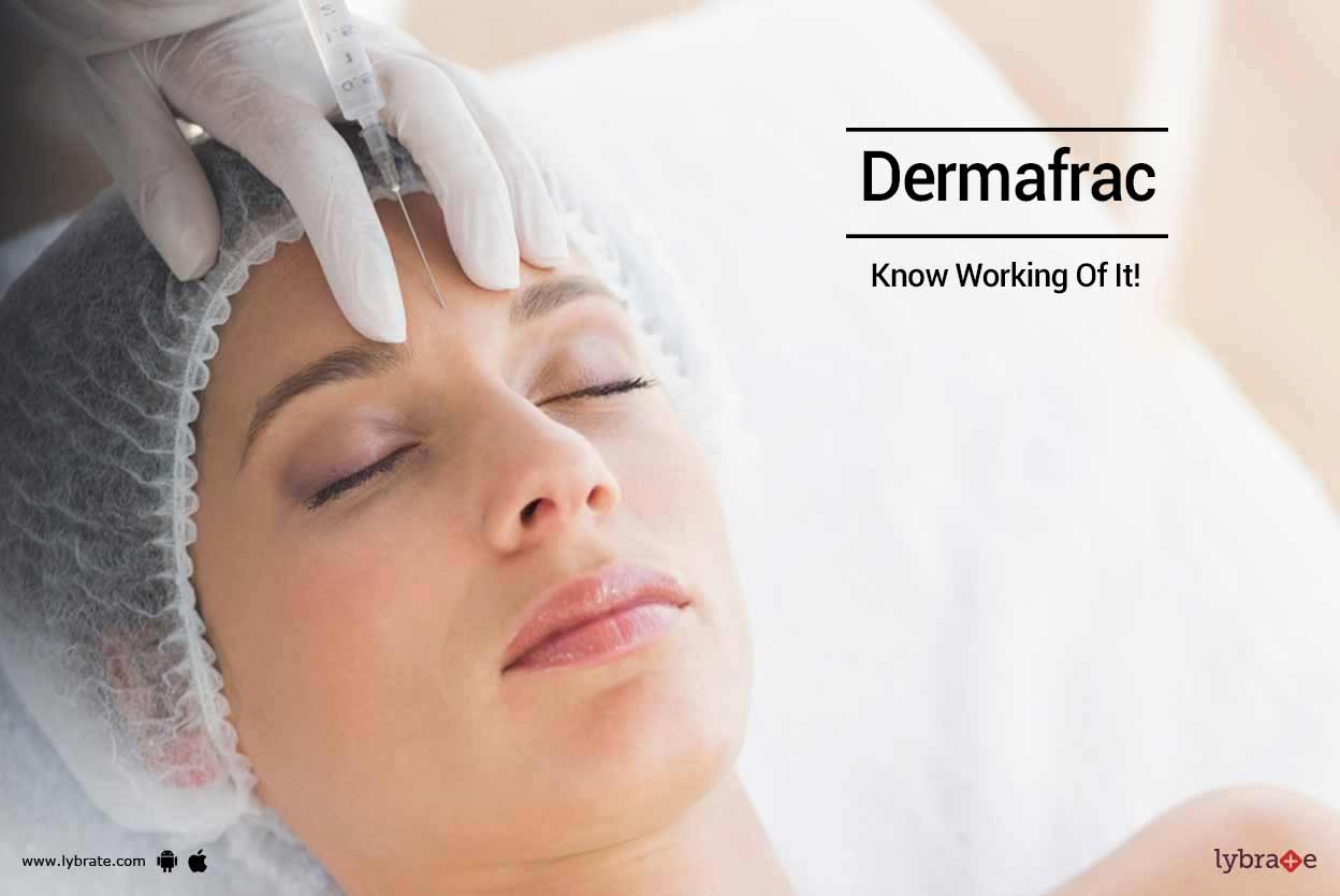Dermafrac - Know Working Of It! - By Dr. Manju Keshari | Lybrate