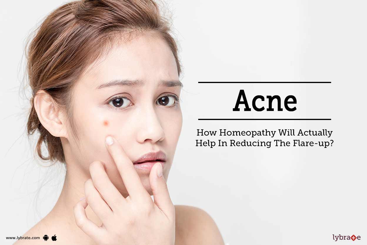 Acne - How Homeopathy Will Actually Help In Reducing The Flare-up? - By ...