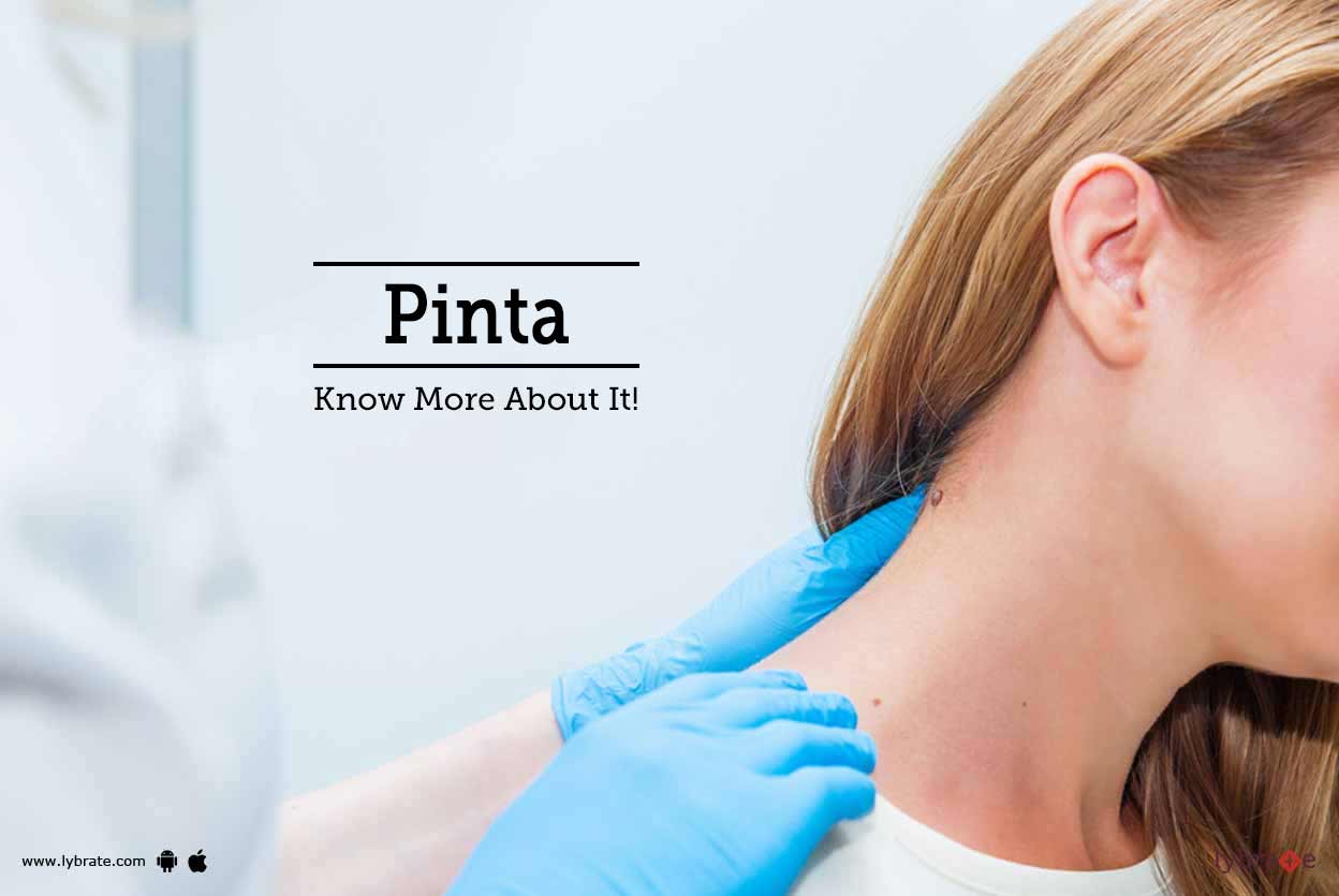 Pinta - Know More About It! - By Sakhiya Skin Clinic Private Limited ...