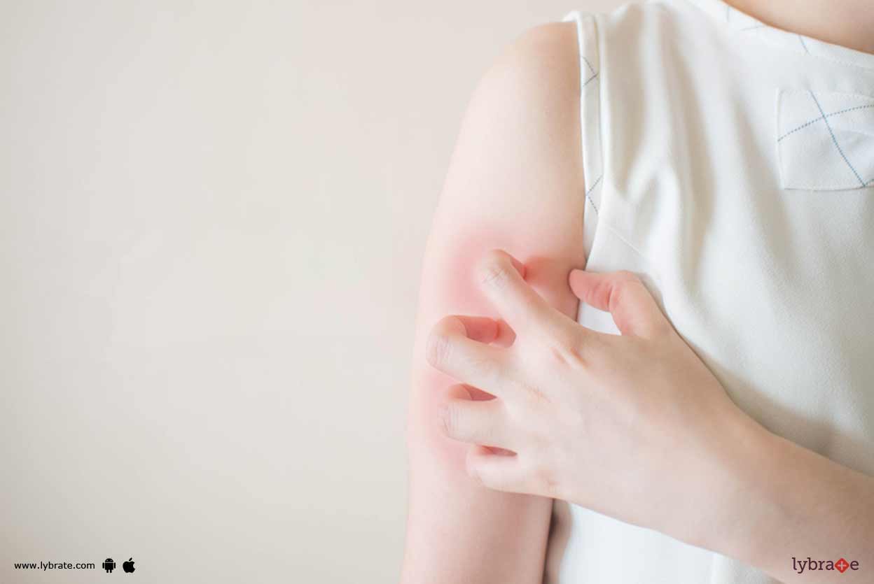 Drug Rashes - How To Handle Them? - By Dr. Ganesh Avhad | Lybrate