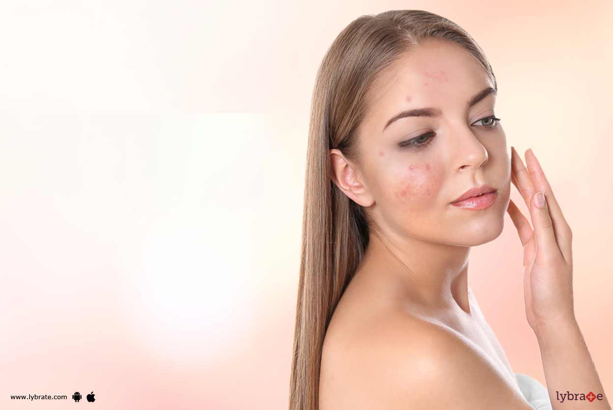 Scar Removal Without Surgery - What Should You Know? - By Sculpt ...
