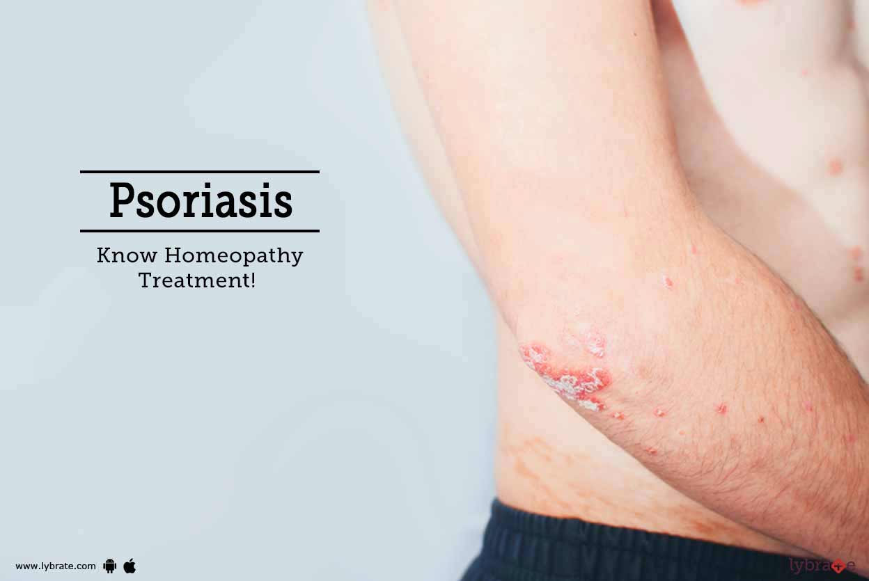 Psoriasis - Know Homeopathy Treatment! - By Dr. Mayur Modi | Lybrate