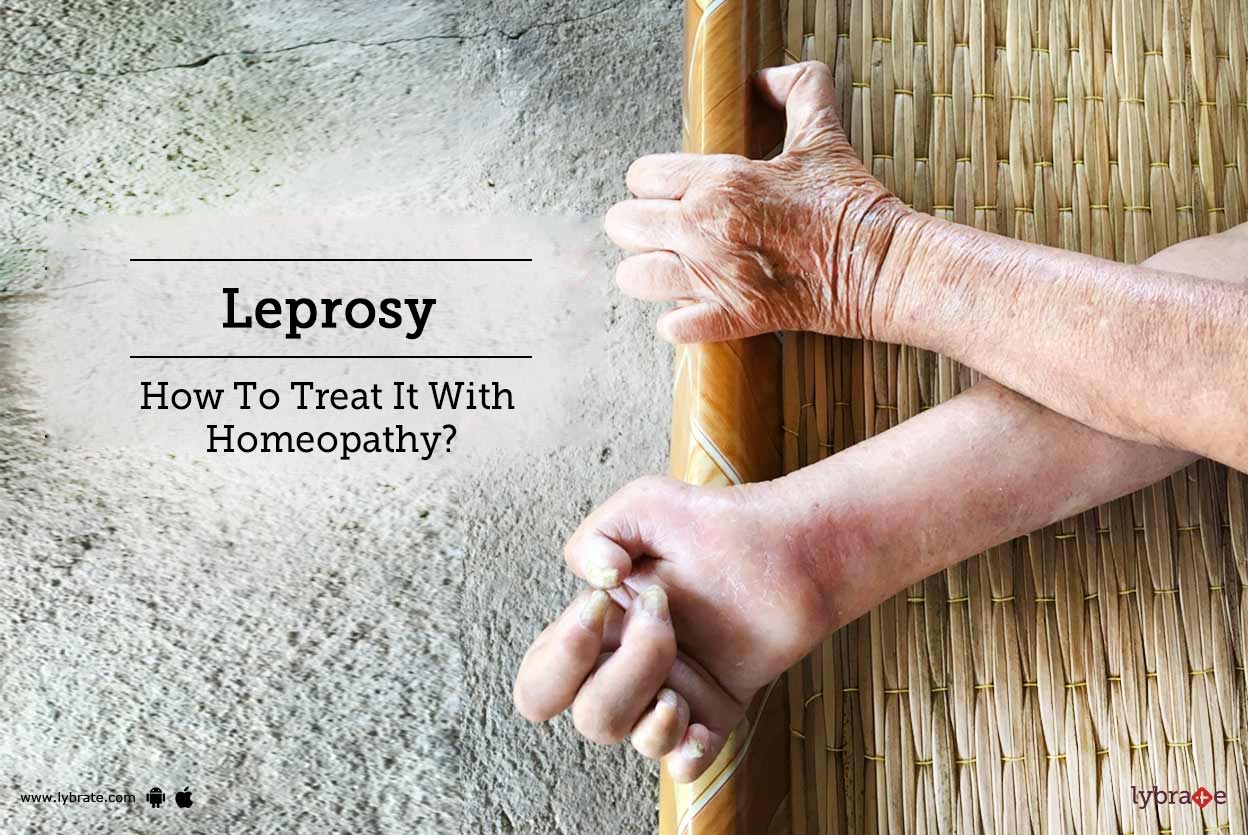 Leprosy - How To Treat It With Homeopathy? - By Dr. Anita Singla | Lybrate