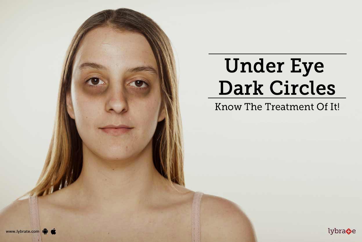 Under Eye Dark Circles - Know The Treatment Of Them! - By Dr. Shaurya ...