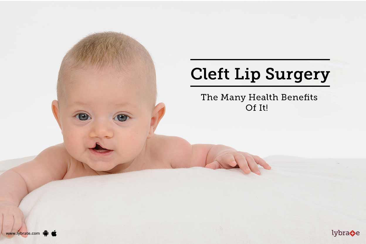 Cleft Lip Surgery - The Many Health Benefits Of It! - By Dr. Manoj ...
