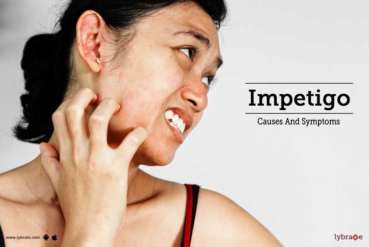 Impetigo - Causes And Symptoms - By Dr. Sanjana Nair | Lybrate