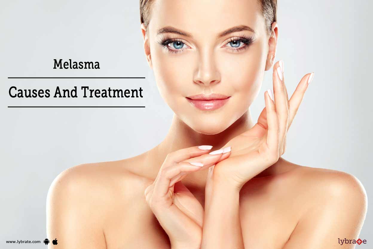Melasma - Causes And Treatment - By Dr. Atula Gupta | Lybrate