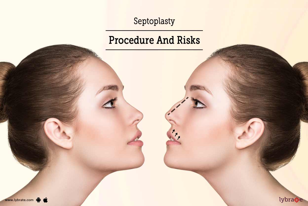 Septoplasty - Procedure And Risks - By Dr. Shashidhar | Lybrate