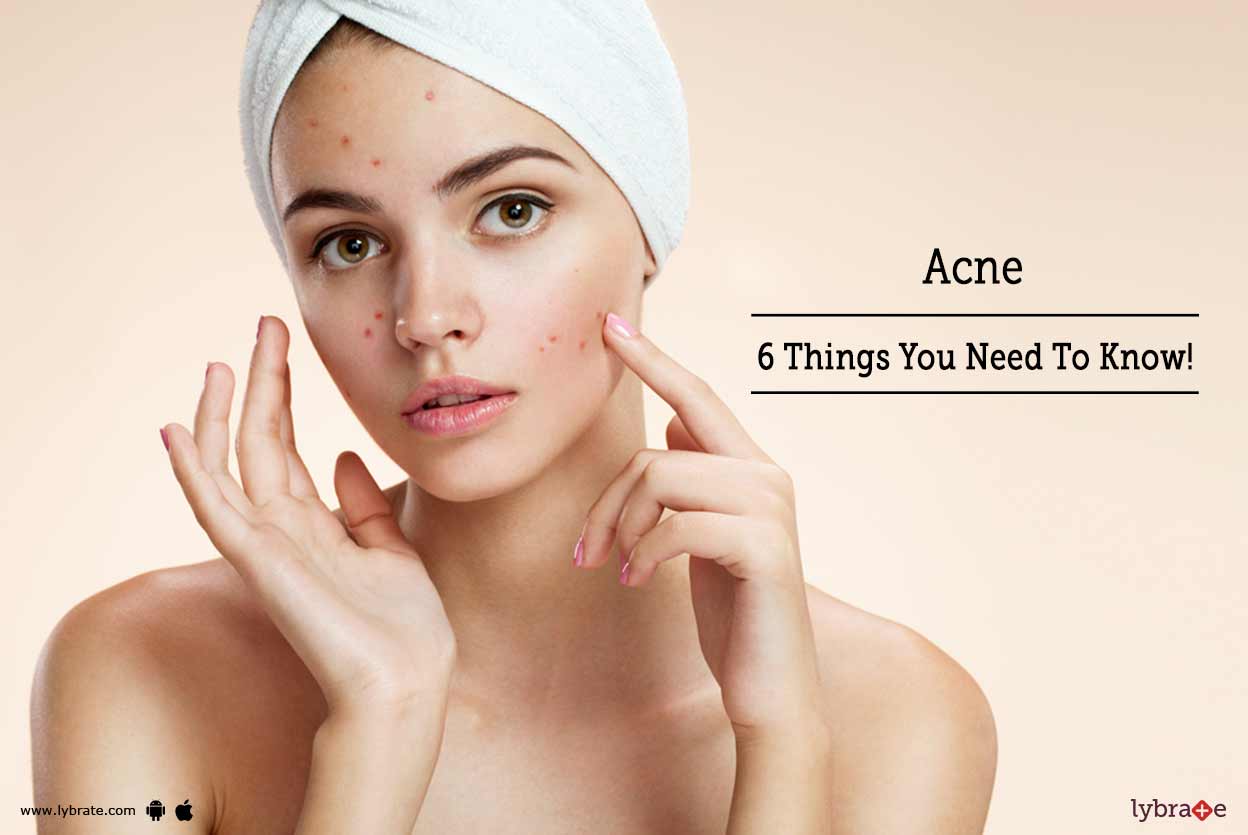 Acne: 6 Things You Need To Know! - By Pure Touch - Skin Hair & Laser ...