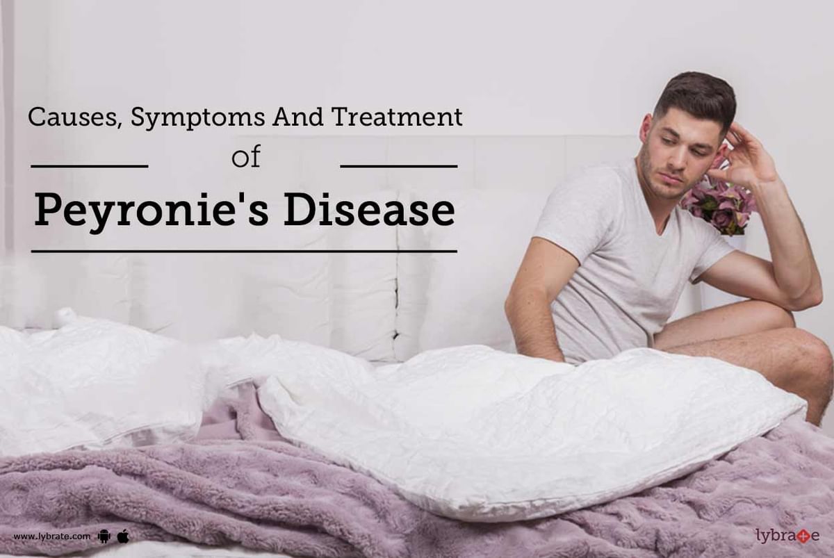 Causes Symptoms And Treatment Of Peyronies Disease By Dr Duraisamy