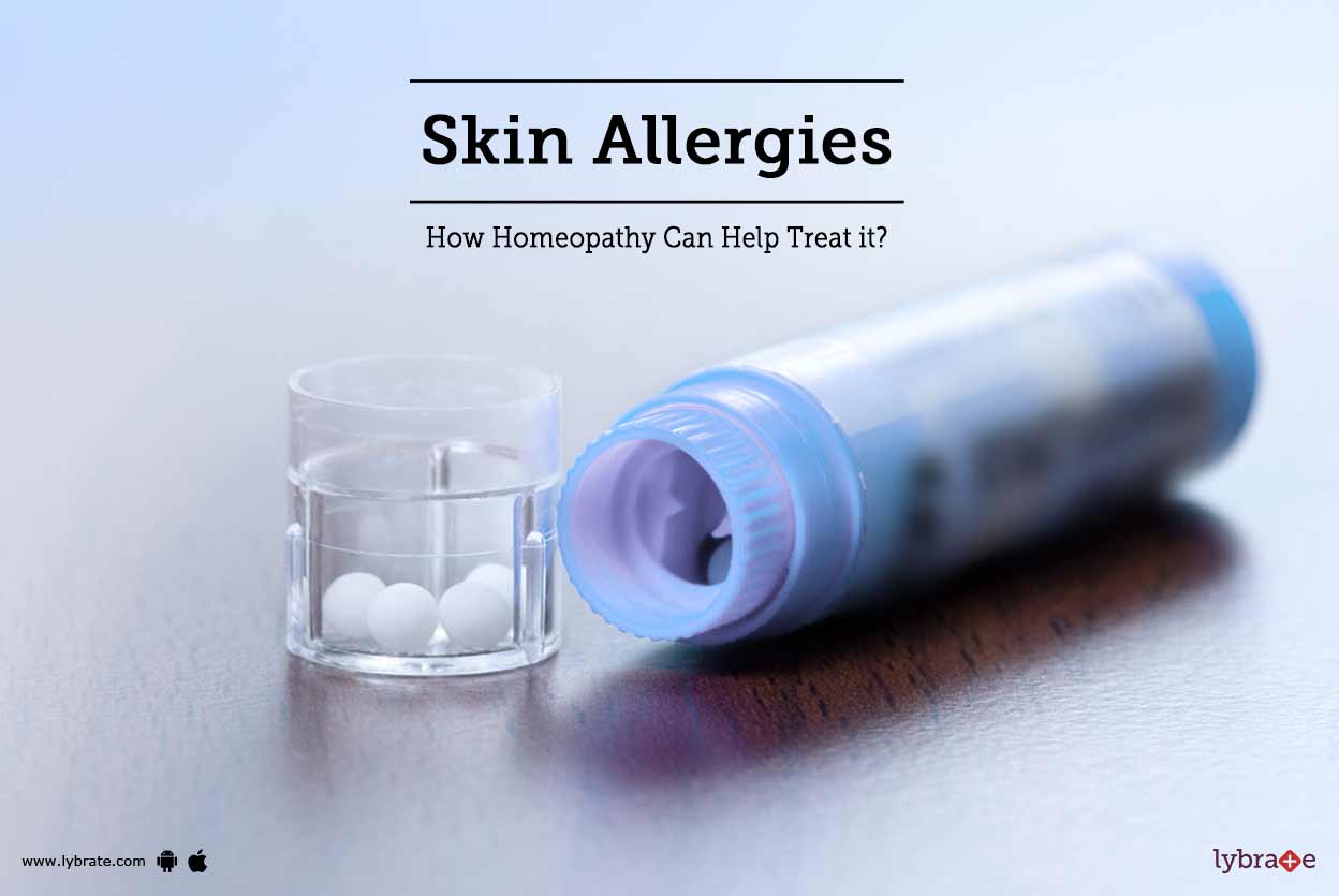 Skin Allergies How Homeopathy Can Help Treat It By Dr Ritu Singh