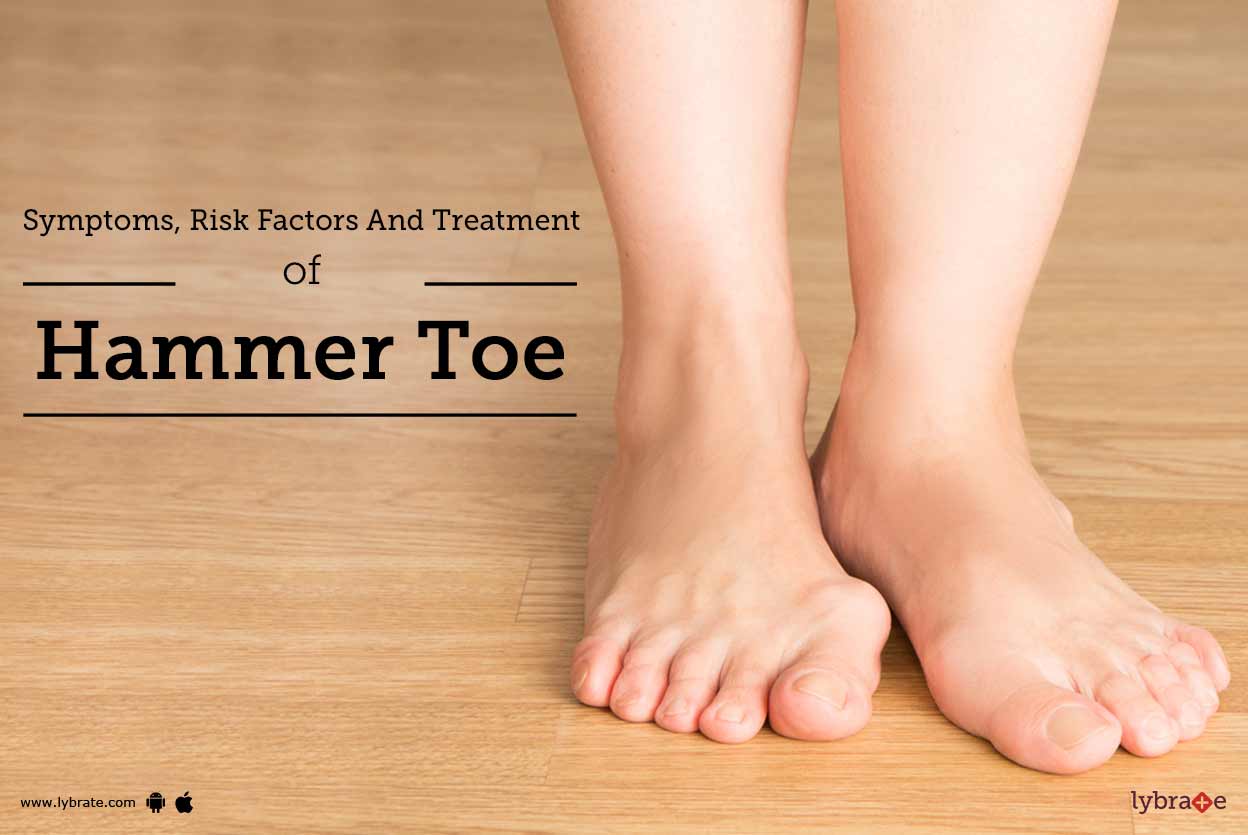 Symptoms, Risk Factors And Treatment of Hammer Toe - By Dr. Jitender ...