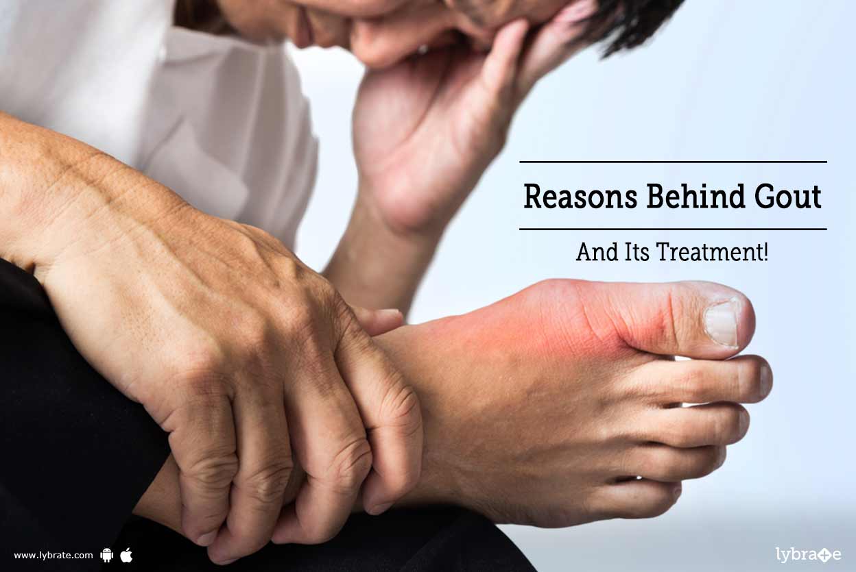 Reasons Behind Gout And Its Treatment! - By Dr. Akram Jawed | Lybrate