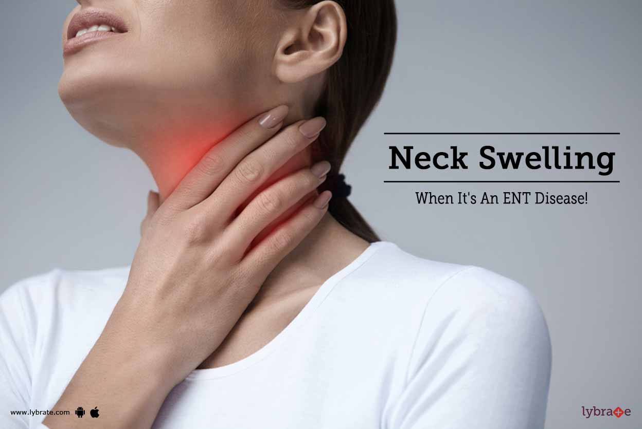 Neck Swelling - When It's An ENT Disease!! - By Dr. Anjan Jyoti Bhuyan ...