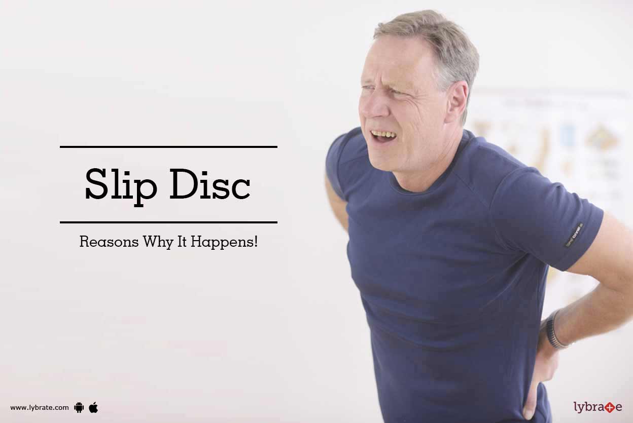 Slip Disc - Reasons Why It Happens! - By Dr. Vishal Nigam | Lybrate