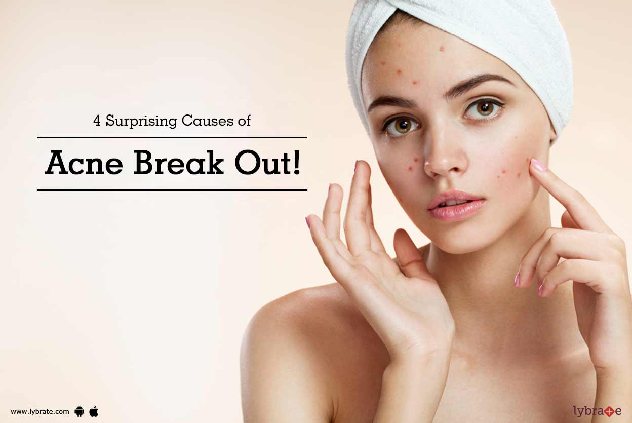 4 Surprising Causes Of Acne Break Out By Dr Vinay Kumar Theeda