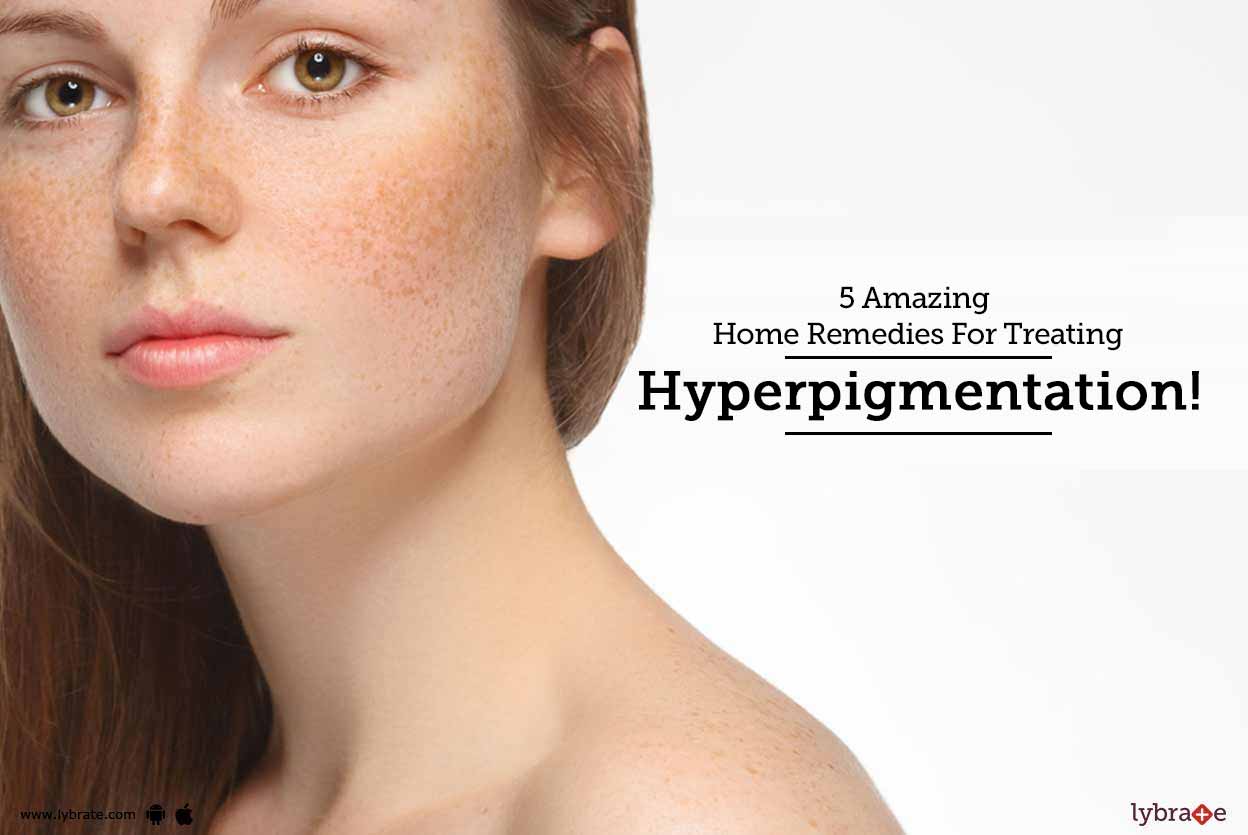 5 Amazing Home Remedies For Treating Hyperpigmentation! - By Dr ...
