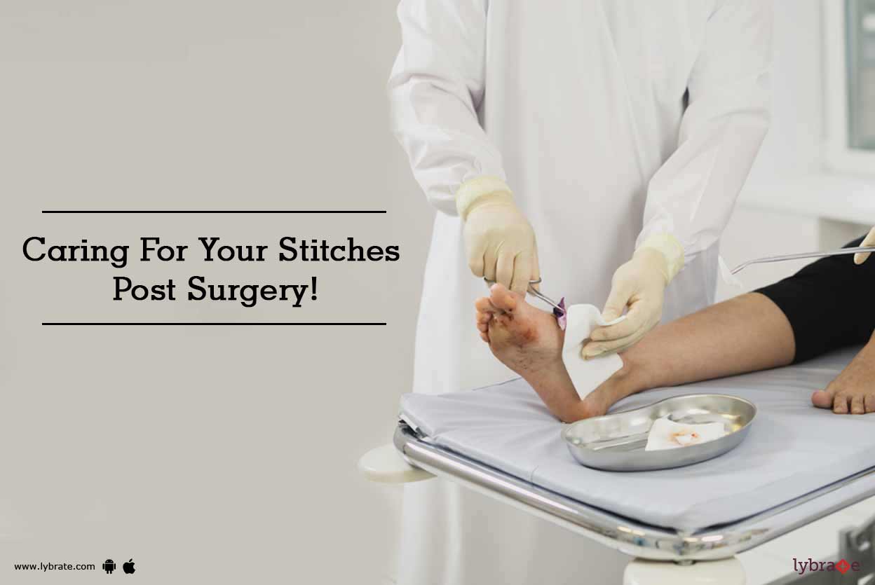 Caring For Your Stitches Post Surgery! - By Dr. Ashish Ganatra | Lybrate