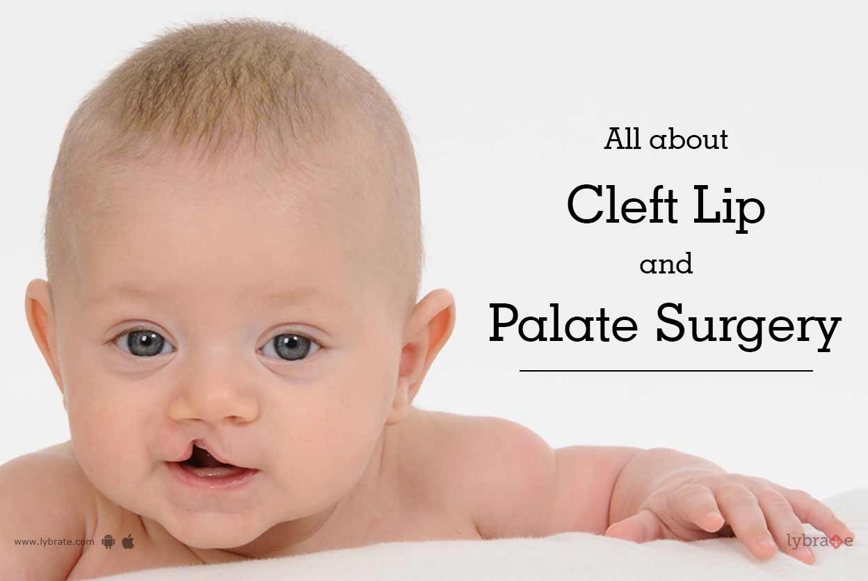 All About Cleft Lip and Palate Surgery - By Dr. Yv Rao | Lybrate