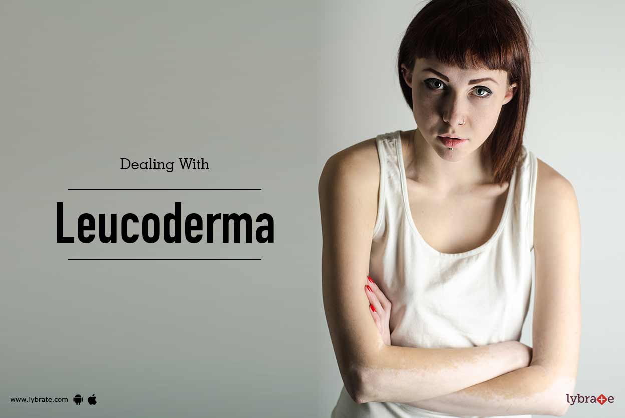 Dealing With Leucoderma - By Dr. Rohit Goel | Lybrate