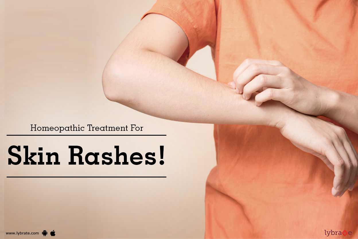 Homeopathic Treatment For Skin Rashes! - By Dr. Ramneek Gupta | Lybrate