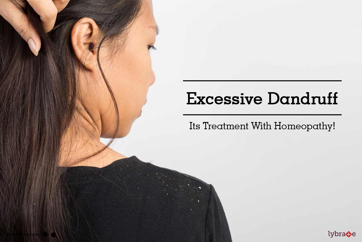 Excessive Dandruff - Its Treatment With Homeopathy! - By Dr. Nandini ...