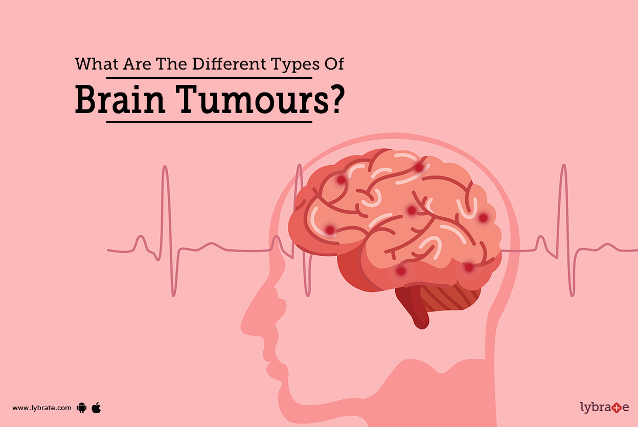 What Are The Different Types Of Brain Tumours? - By Dr. Sankalp Mohan ...