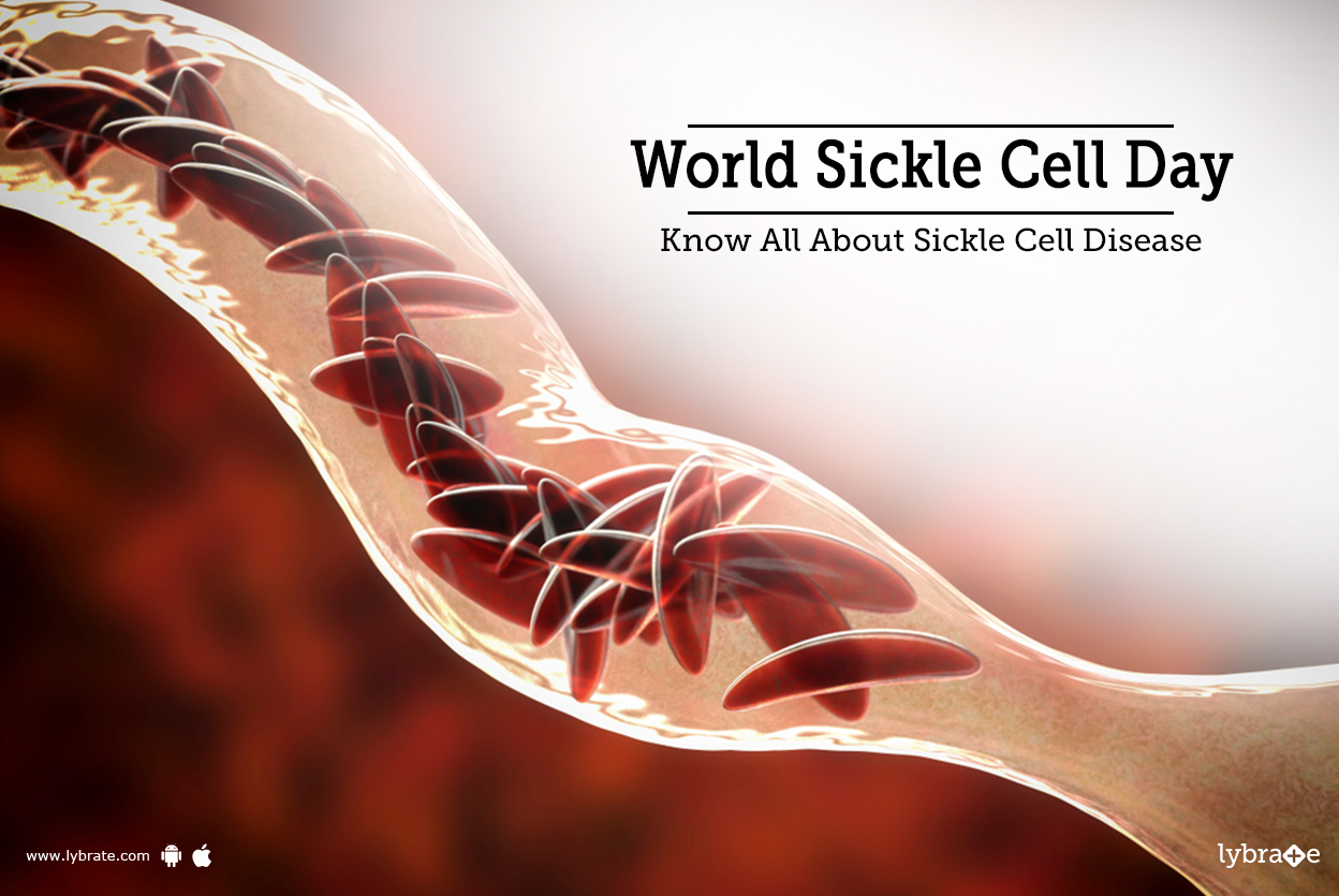 World Sickle Cell Day: Know All About Sickle Cell Disease - By Dr ...