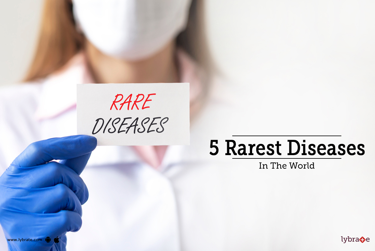 5 Rarest Diseases In The World - By Dr. Goutham Kumar | Lybrate